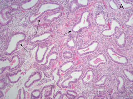 solunetti: Kohdun limakalvo (sekretorinen)