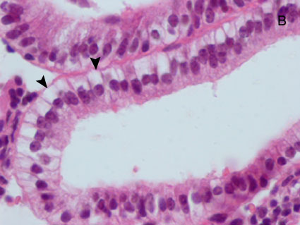 solunetti: Kohdun limakalvo (sekretorinen)